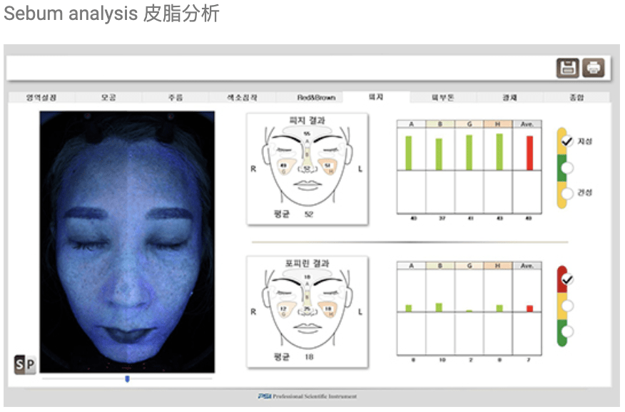 Mark-VU - Face Factor Aesthetics Centre