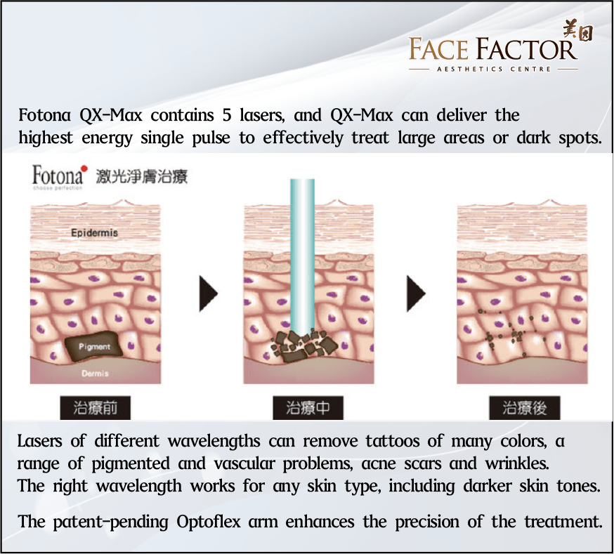 Fotona - Face Factor Aesthetics Centre